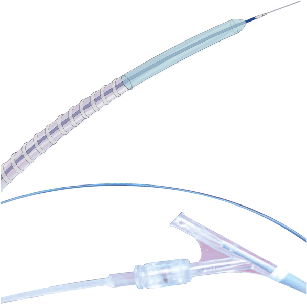 Supply PeriUltra™ PTA Spiral Twin-Wall High Pressure Balloon Dilatation ...