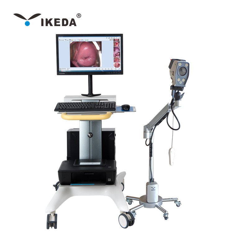 Supply Digital Video Colposcope Equipment for cervix vagina examination ...