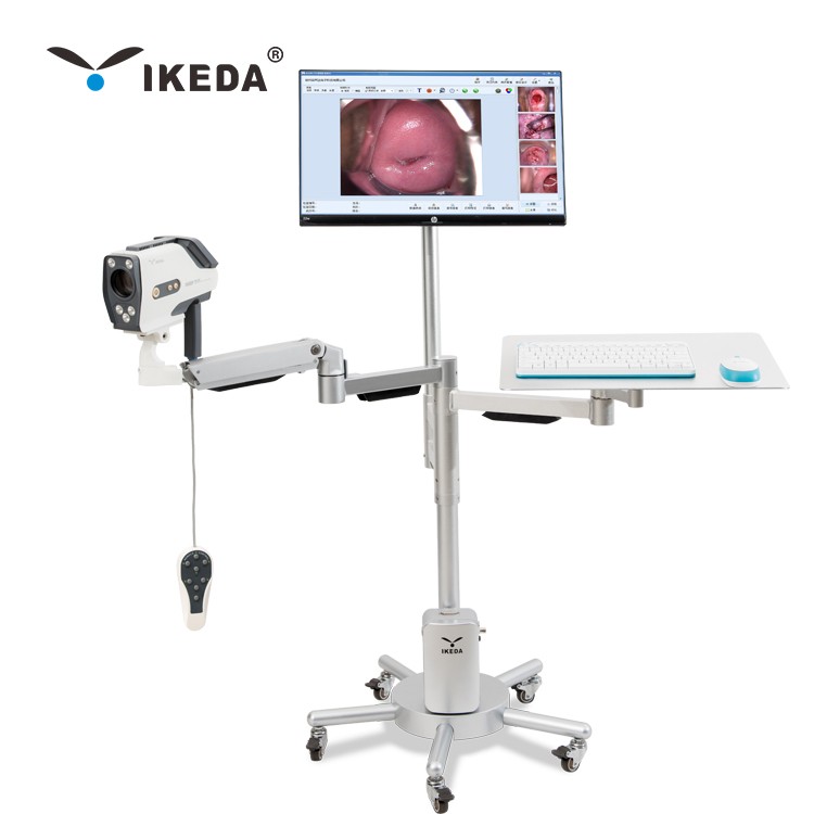 Supply Digital Video Colposcope Equipment for cervix vagina examination ...