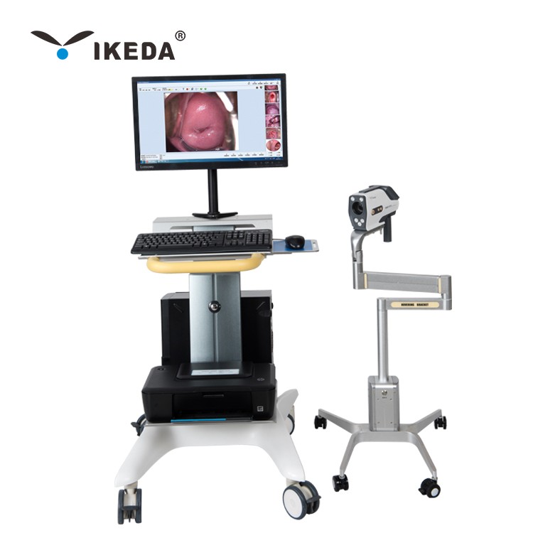 Supply HD Colposcopy Video Camera manufacturer Wholesale Factory ...