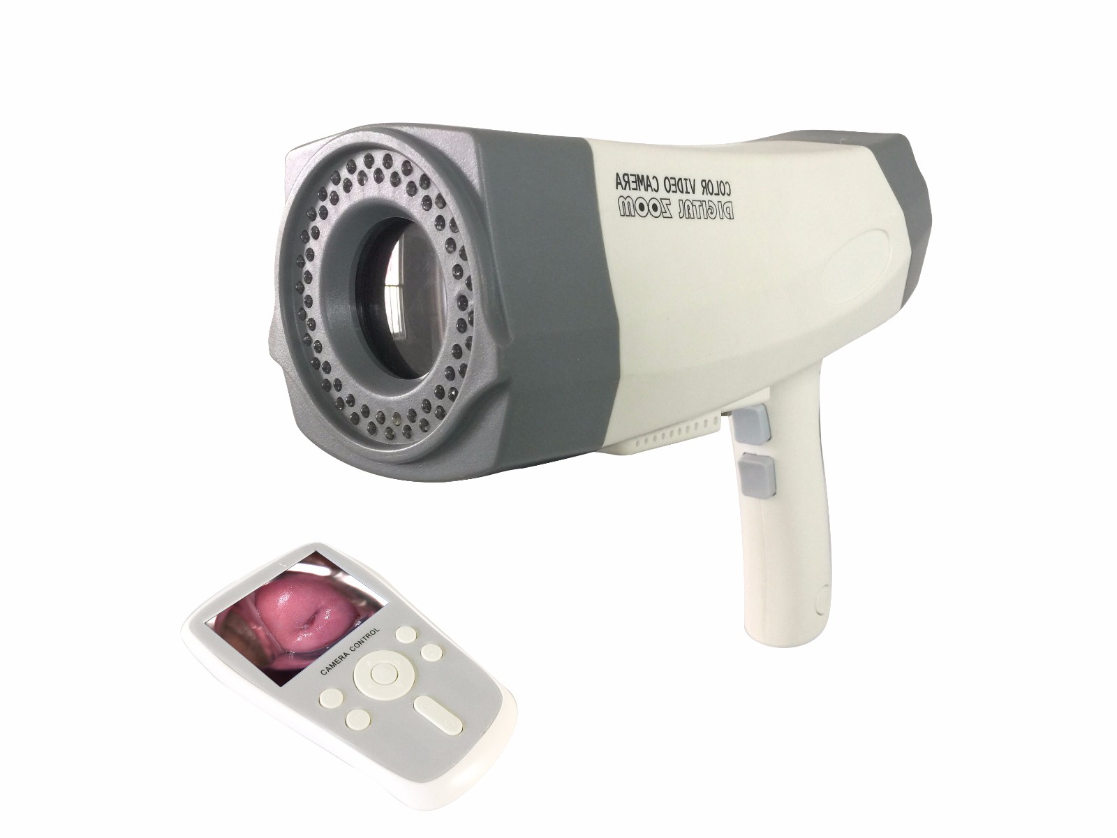 Supply Portable Colposcope Camera Sony Ccd Camera Colposcope Camera ...