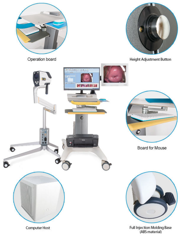 Supply Digital Video Colposcope for gynecology Factory Quotes - OEM