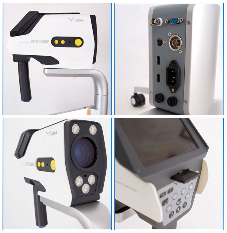 Supply HD colposcope camera Wholesale Factory - XUZHOU AKX ELECTRONIC ...