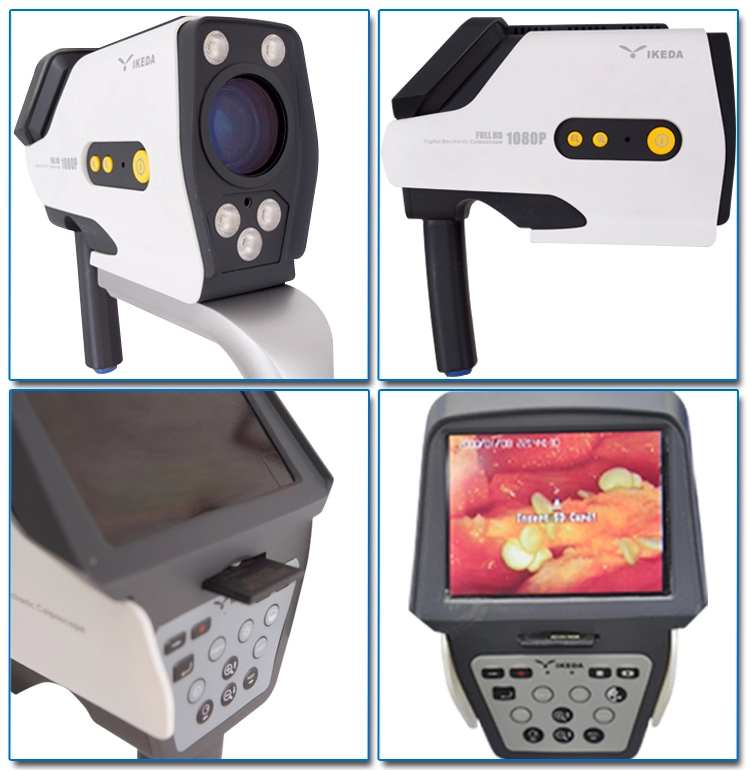 Supply video colposcope price Wholesale Factory - XUZHOU AKX ELECTRONIC ...