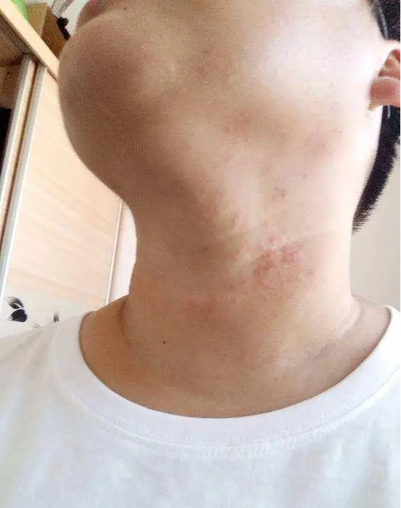 Supply External Powder for Prickly Heat Wholesale Factory - Changsha ...