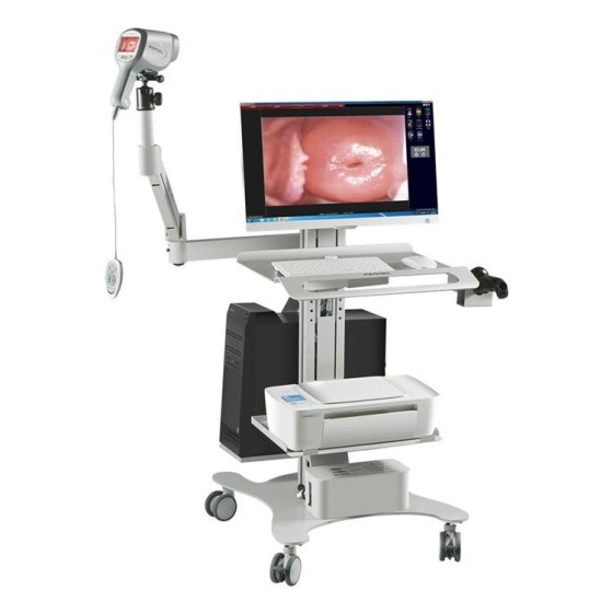Supply Full HD Gynecological Digital Video Colposcope Equipment KN ...